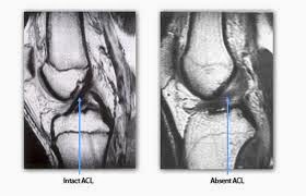 Medical Treatment Pictures-for Better Understanding: Arthroscopic ...