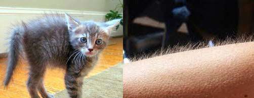 MBBS DOCTORS: Goosebumps Medical Term Meaning