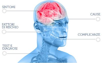 quaeram: Ho mal di testa, sintomi per riconoscere emicrania
