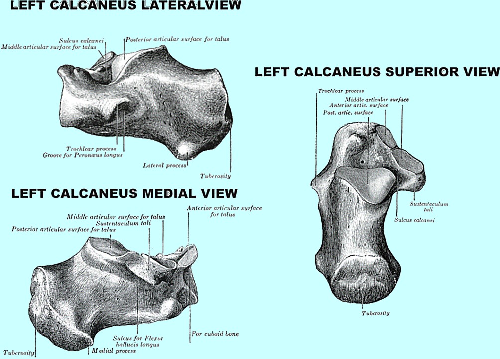 Un Jour En Chirurgie Orthopedique Et Traumatologique: Fracture du calcaneum