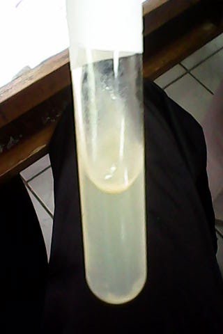 Praktikum Mikrobiologi (Pembuatan Medium Dan Kulturisasi dari Isolat ...