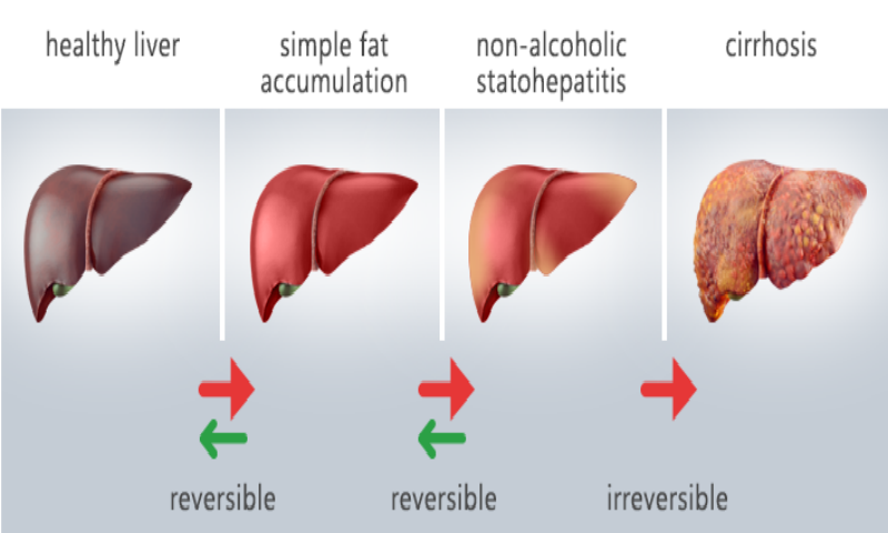 Olijfolie & Meer: Leverschade: Zonnebloemolie vs. Olijfolie