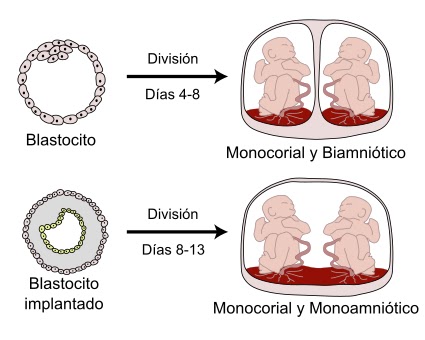 Papa novato con trillis: Los Gemelos "Monocorial Monoamniótico" o ...