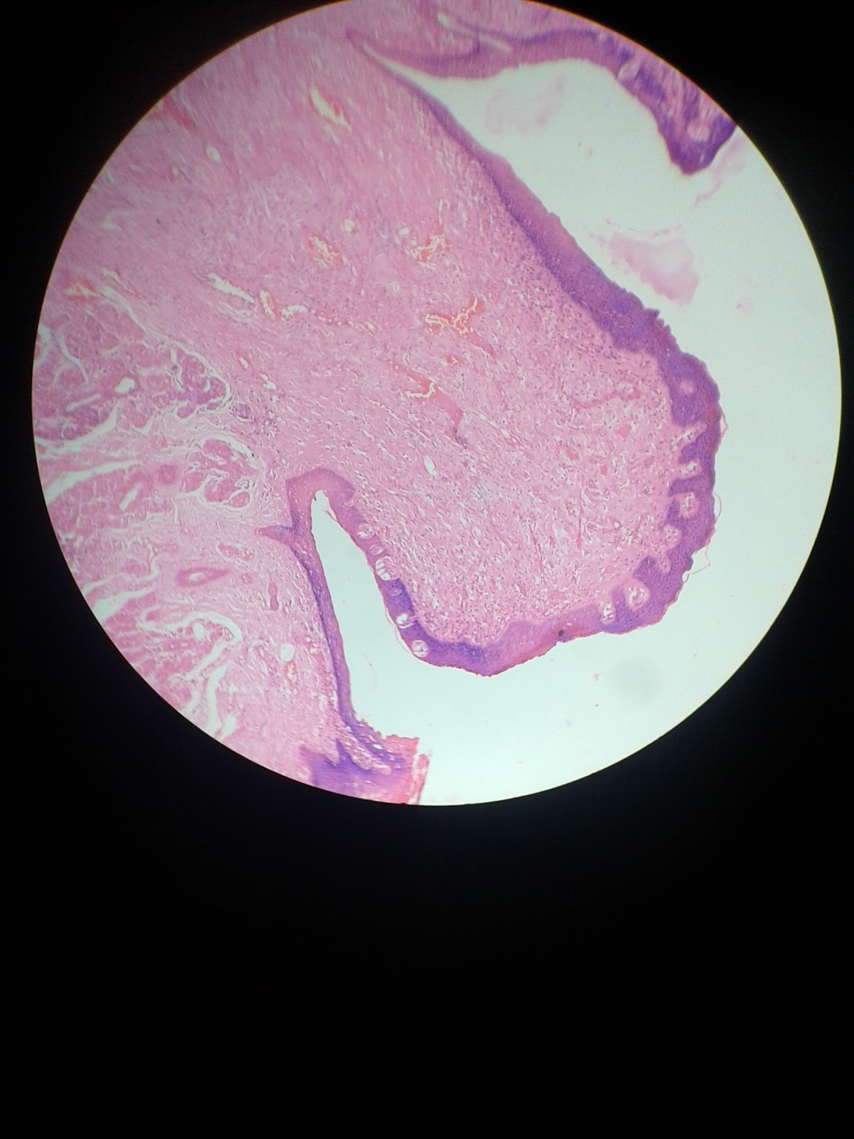 Dentosphere : World of Dentistry: Oral Histology Slides - Papilla of ...