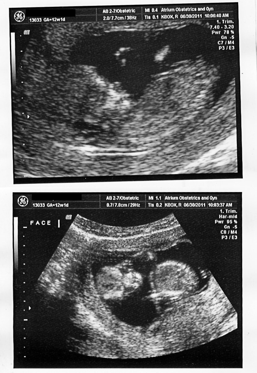 Two's Company. Three's a Family.: Baby Blurbs