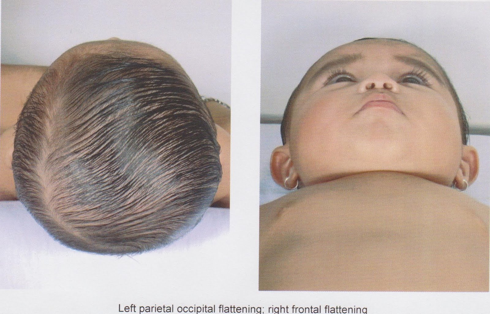 My Everyday Extraordinaire: A Helmet