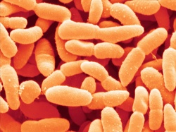 GM5_Diversitat de microorganismes i aplicacions: Acetobacter spp.
