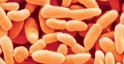 GM5_Diversitat de microorganismes i aplicacions: Acetobacter spp.