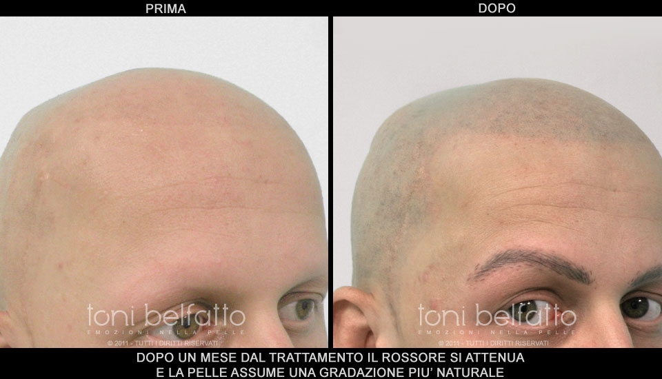Come avere un look rasato da sogno con la Tricopigmentazione!: luglio 2013