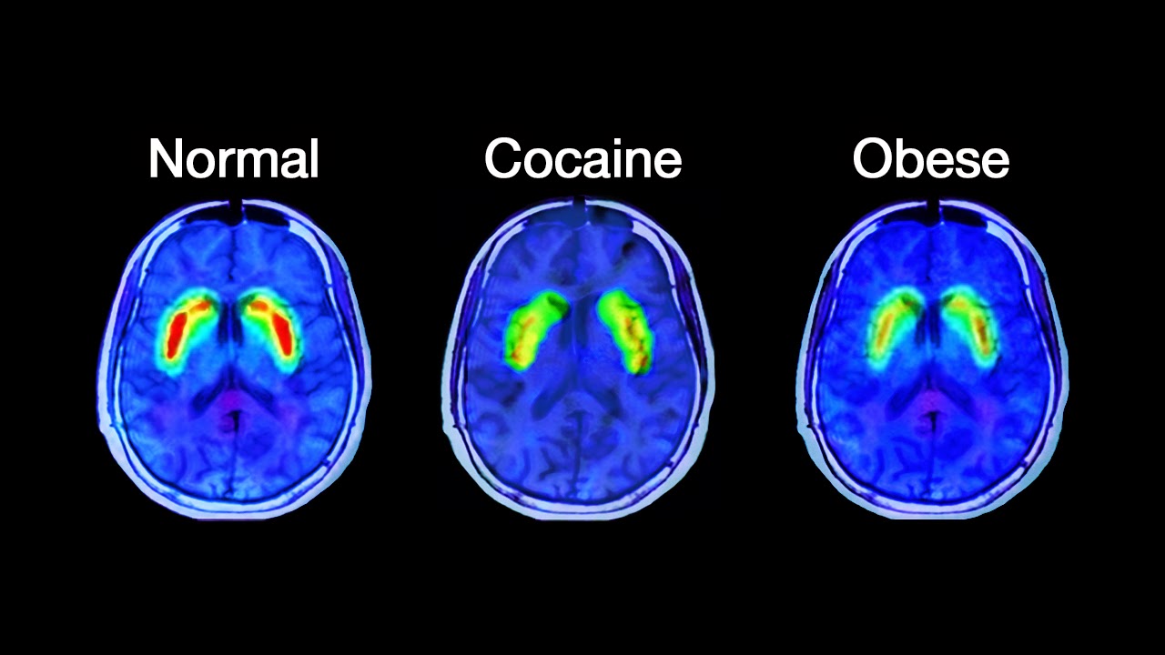 UNADM: EL CEREBRO ADICTO
