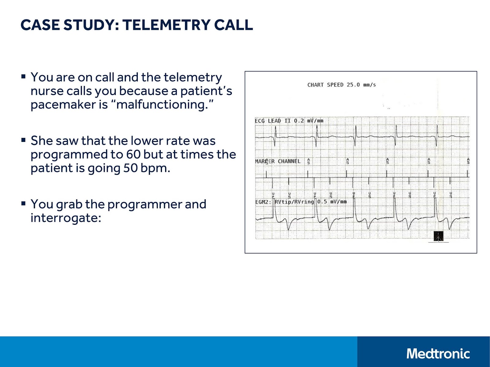 CVT Mohd Farid: Basic Pacing Concepts Part II-Medtronic Academy