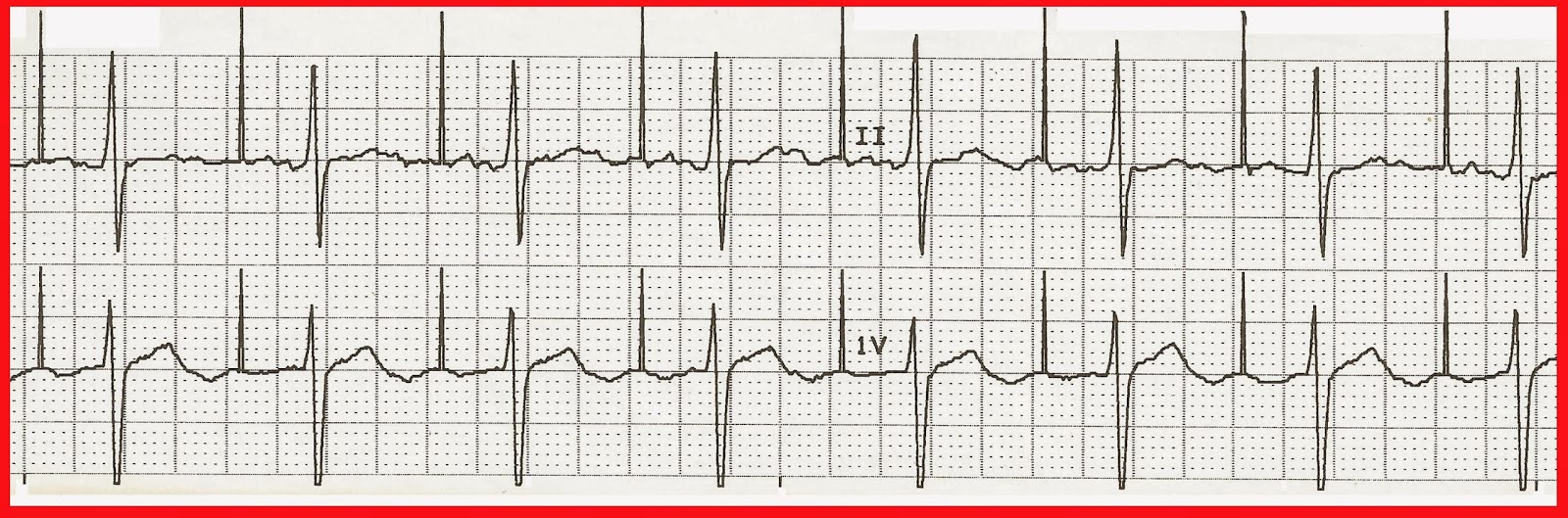 Practice EKG Rhythm Strips 217