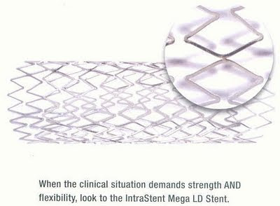Pedi cardiology: Cath: Stents - Intrastent LD