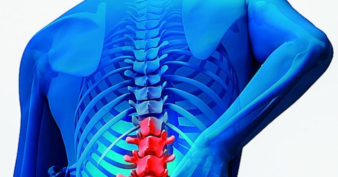 Lumbalgia | Diagnostico Medico