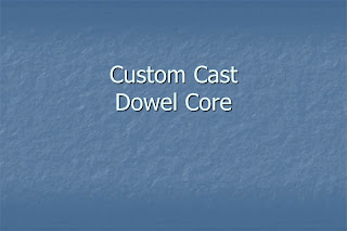 Dentistry: Custom Cast Dowel Core