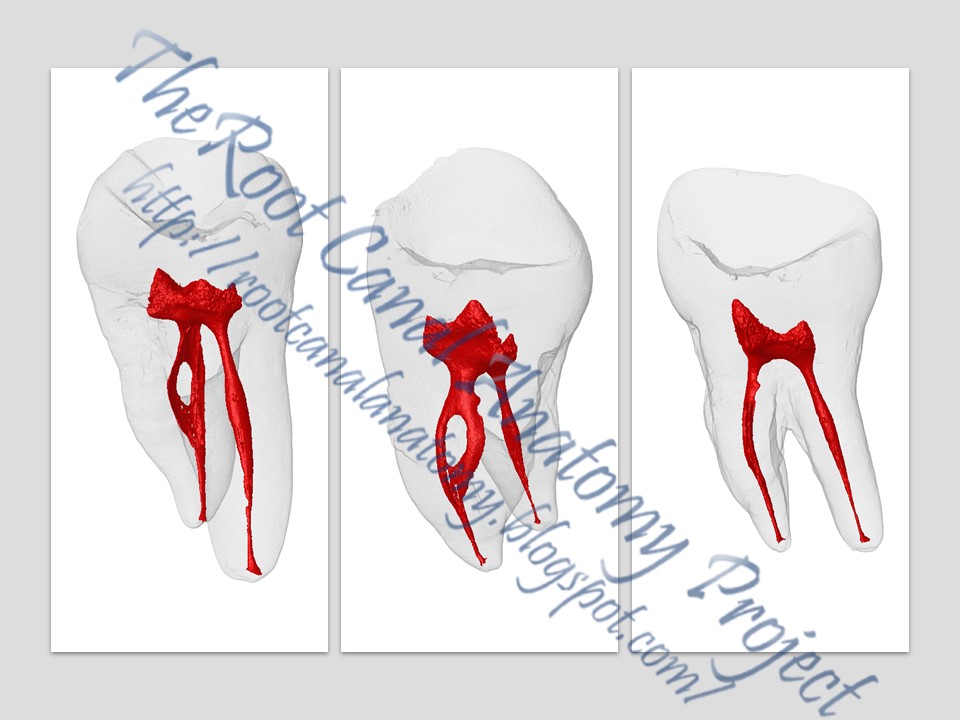 The Root Canal Anatomy Project: Mandibular Second Molar