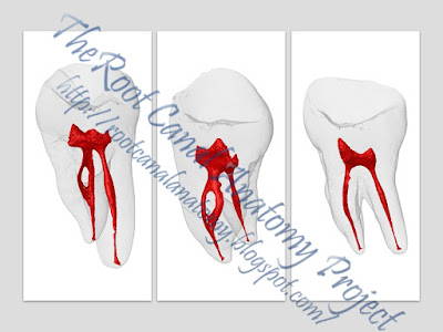 The Root Canal Anatomy Project: Mandibular Second Molar