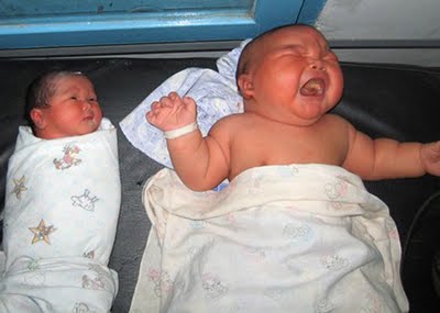 PEQUENOS GIGANTES: Bebê nasceu obeso.