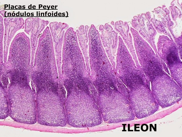 cuidados del sistema linfatico: placas de peyer