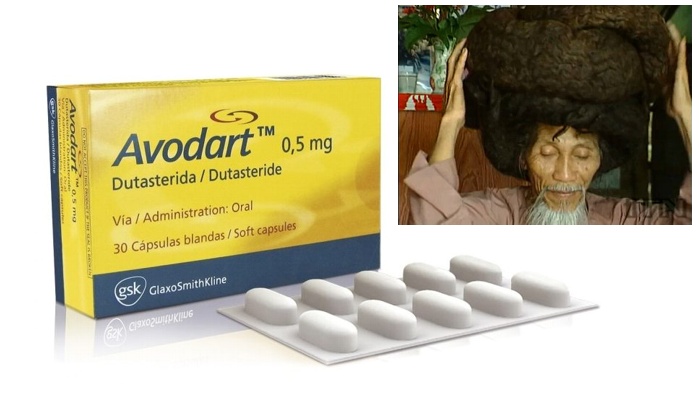 Reviews Coupons: Related Treatment Guides