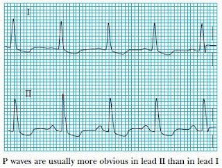 The Human Body: ELECTROCARDIOGRAPHY-II (Basic terminology)
