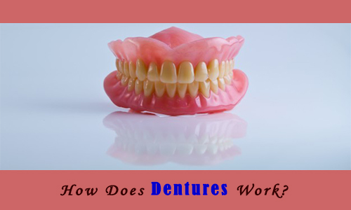 Hamilton Denture Clinic - How Does Dentures Work?