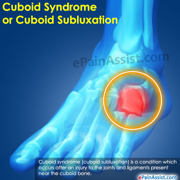 A Few Charms: Accept where you are and start where you're at