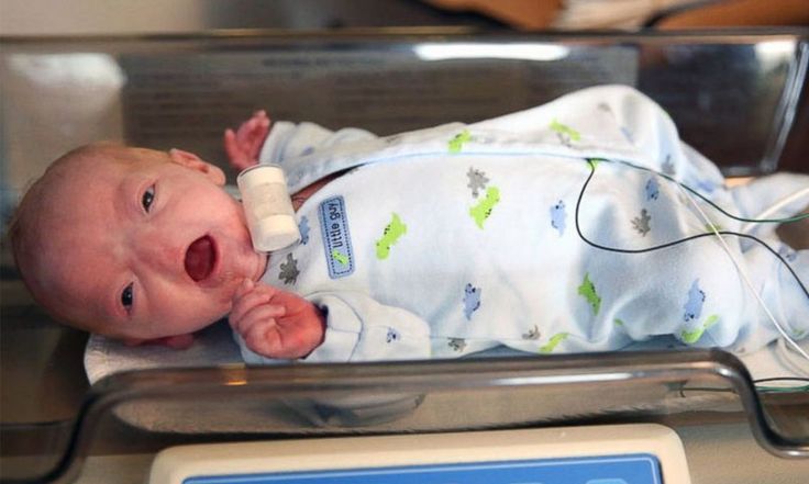 See Now: This Baby Was Born Without Nose, So Cute! ~ Entertainment News ...