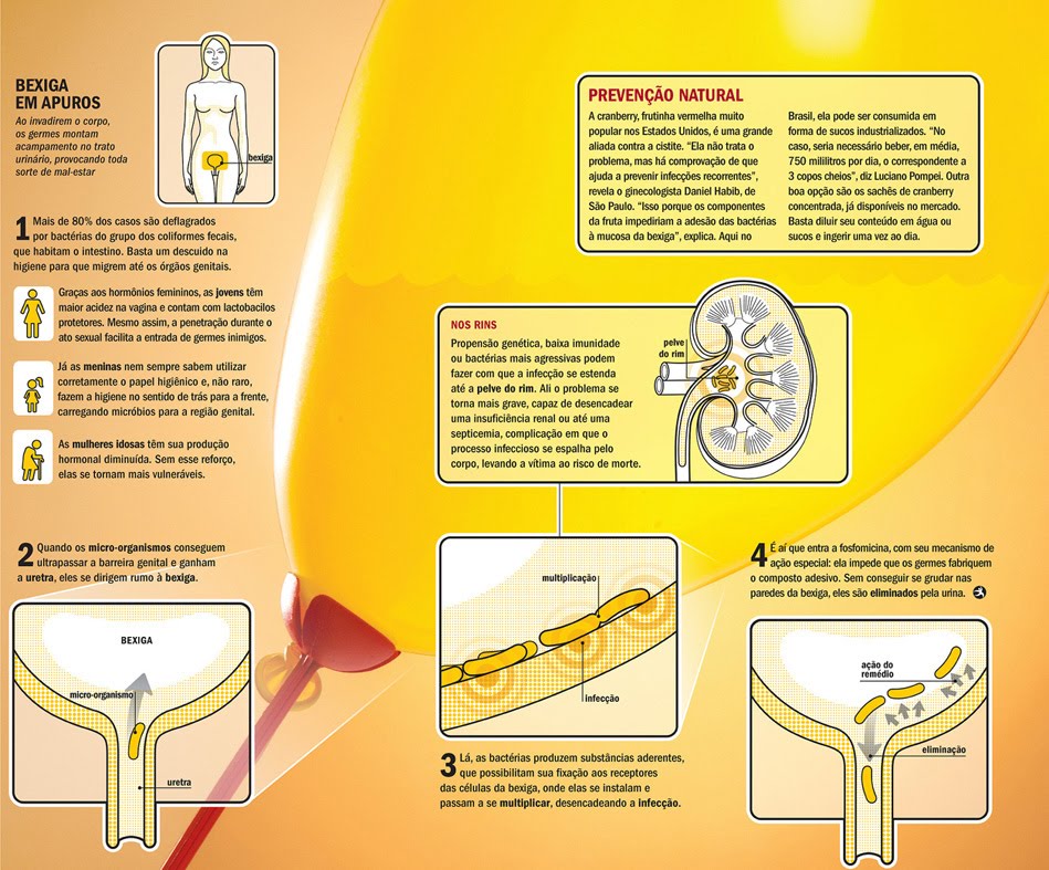 Blog da Cocodia: Cistite