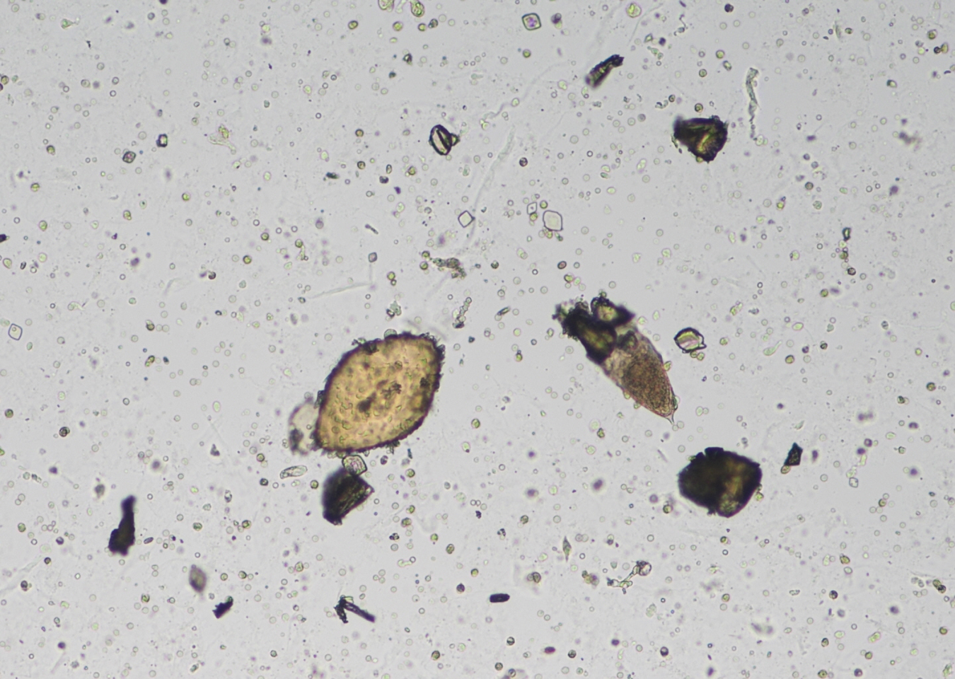 Creepy Dreadful Wonderful Parasites: Case of the Week 511