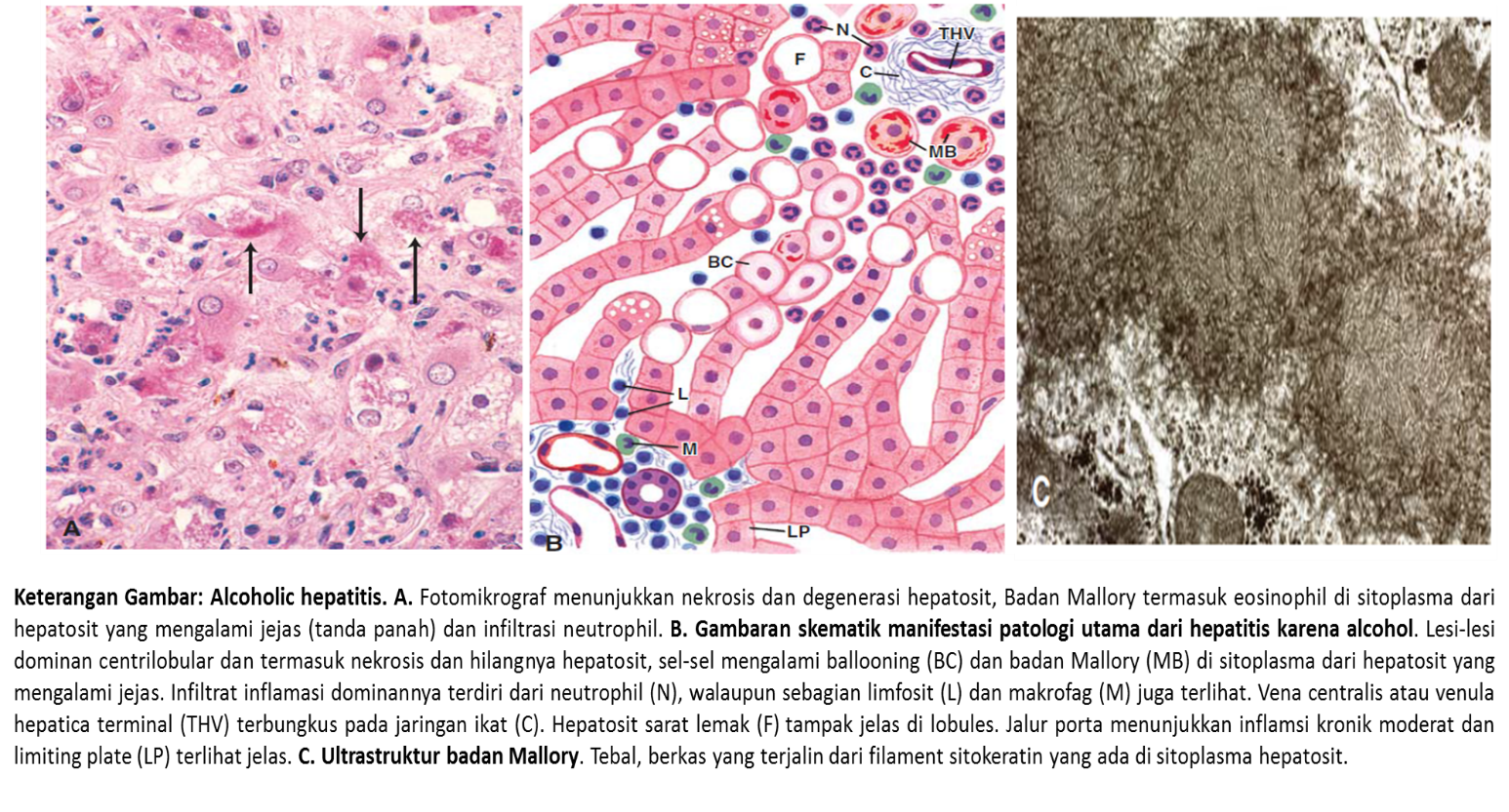 Kehidupan dan Dunia-ku: because it is HEPATITIS