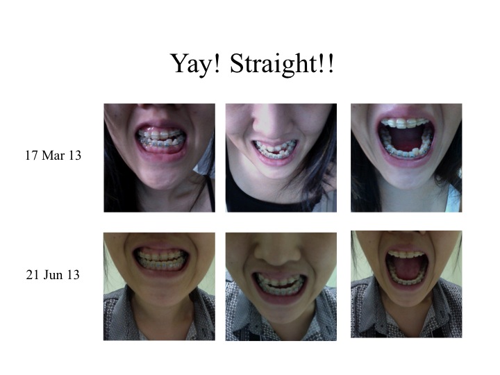 Becoming Ariela: more bracing myself for a new adventure