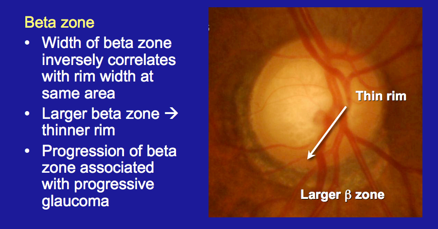 GLAUCOMA SPECIALIST BLOG: "THE GLOG"