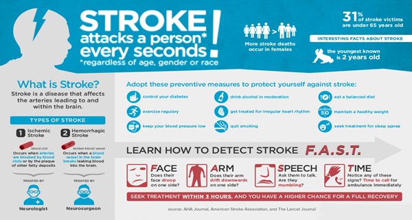 amudu: Signs of a stroke to recognize
