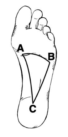 Dr. Tim Maggs: What is Your Child's Foot Type?