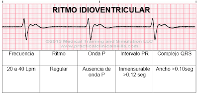 ELECTROCARDIOGRAFÍA BÁSICA PARA ENFERMERÍA: RITMO EN UN ELECTROCARDIOGRAMA