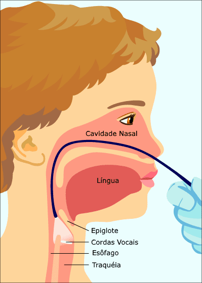 Vivendo com Laringomalácia