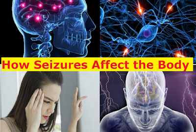 Source: healthguides