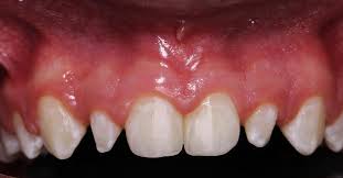 ¿Qué son las Anomalías Dentarias?