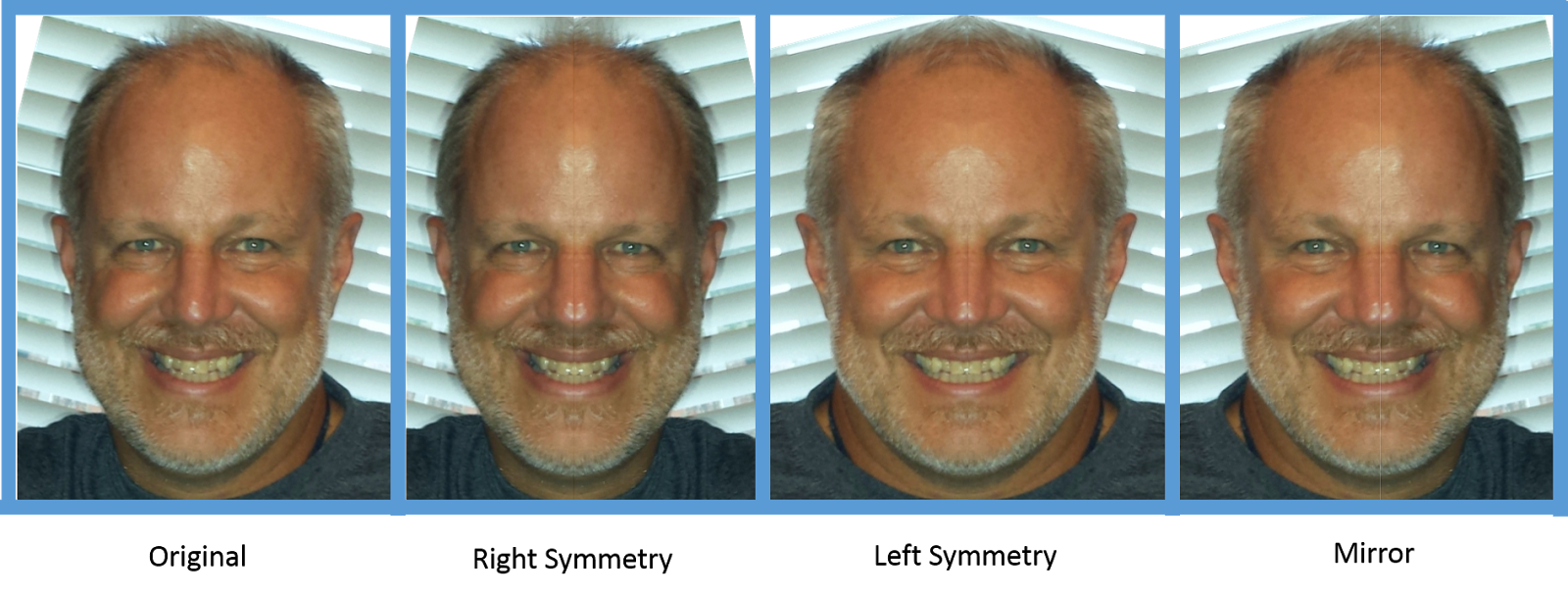 PhilosFX: Expressions: A Look at Facial Symmetry and Its Implications ...