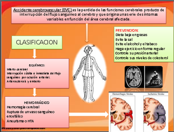 Enfermedad Vascular Cerebral (EVC): noviembre 2016