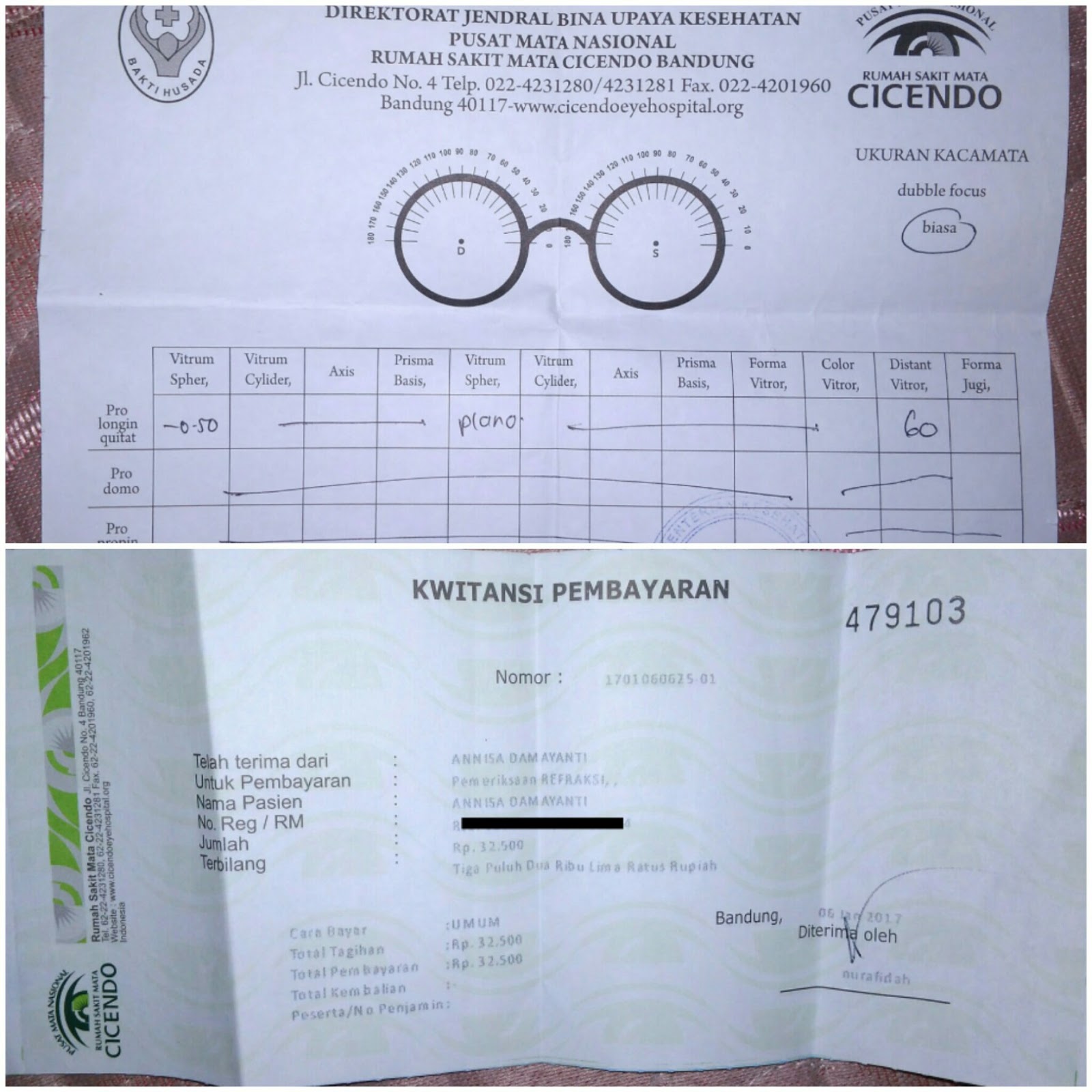 Cara Membaca Resep Kacamata