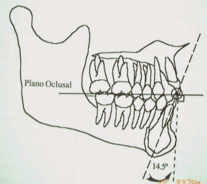 Tareas de Odontología : ANALISIS DE DOWNS