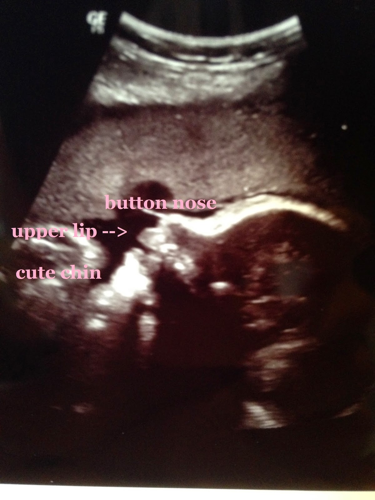 Baby on Board!: 33 Week Ultrasound