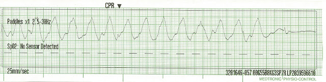 Float Nurse: Code Blue: Cafe Coronary