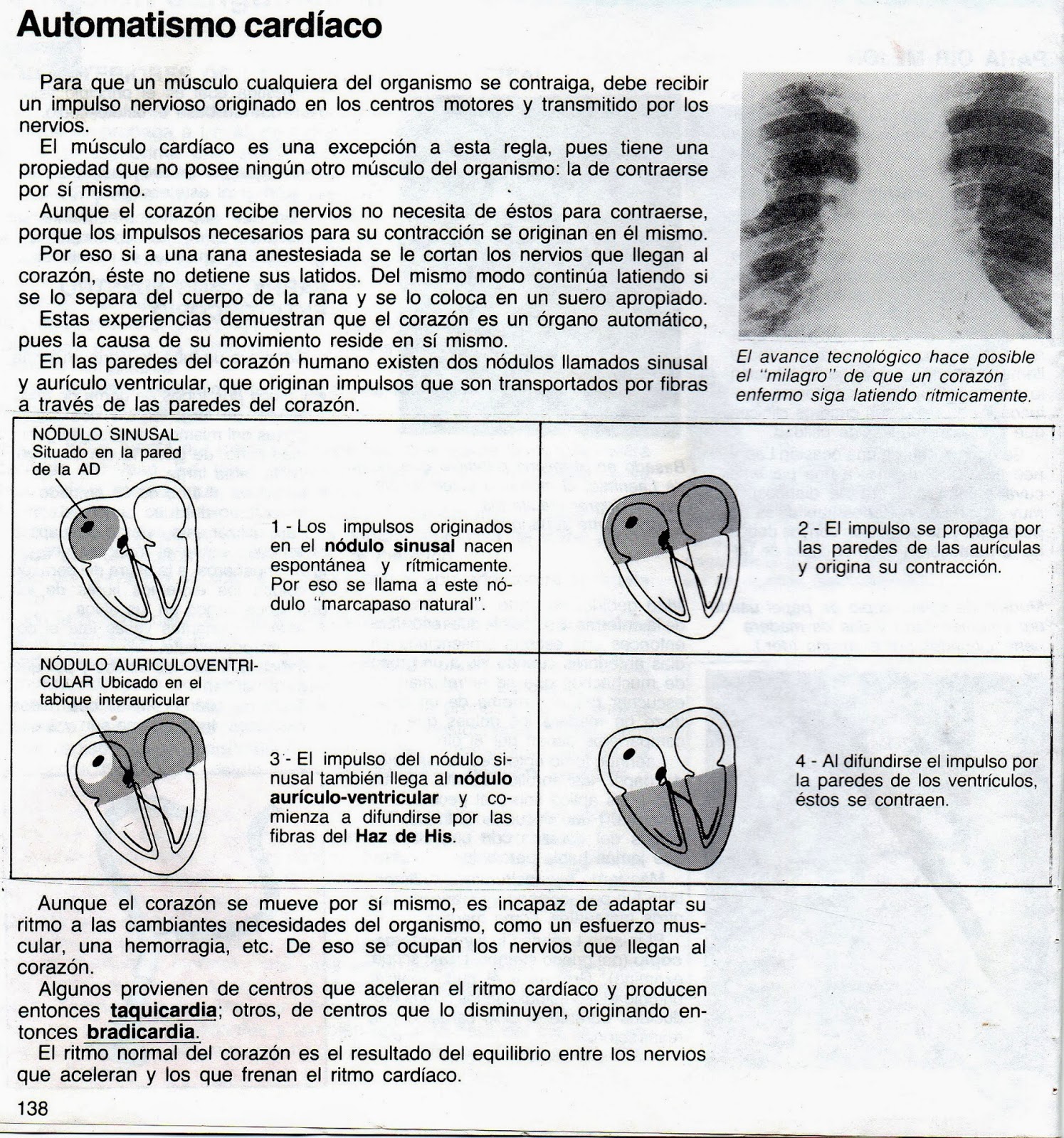 SISTEMA CIRCULATORIO: ACTIVIDAD N°4: AUTOMATISMO CARDÍACO