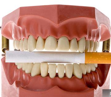 Mouth Cancer : Symptome Ursachen und Abhilfen