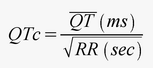 Interval QT | INA - ECG