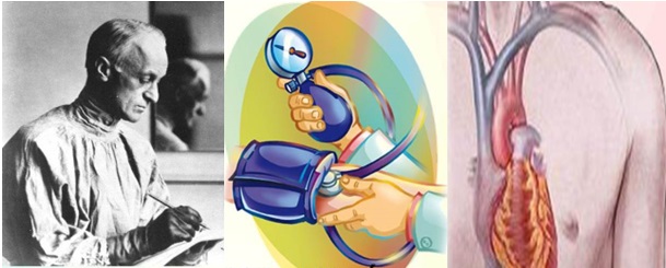 triada de cushing hipertension intracraneal