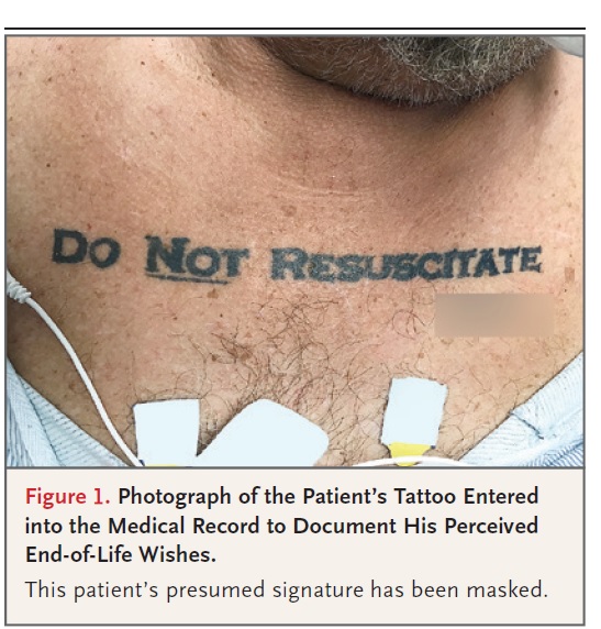 Unconscious Patient With A DNR Tattoo Bioethics unconscious-patient-with-a-dnr-tattoo-bioethics